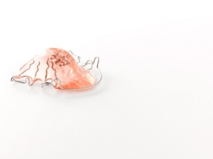 Uitneembare beugel - Orthodontiepraktijk Hilversum